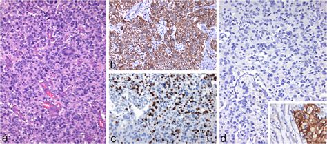 Histological Examination On Formalin Fixed And Paraffin Embedded