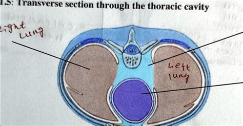 1 5 Transverse Section Through The Thoracic Cavity Transverse Section Through The Thoracic