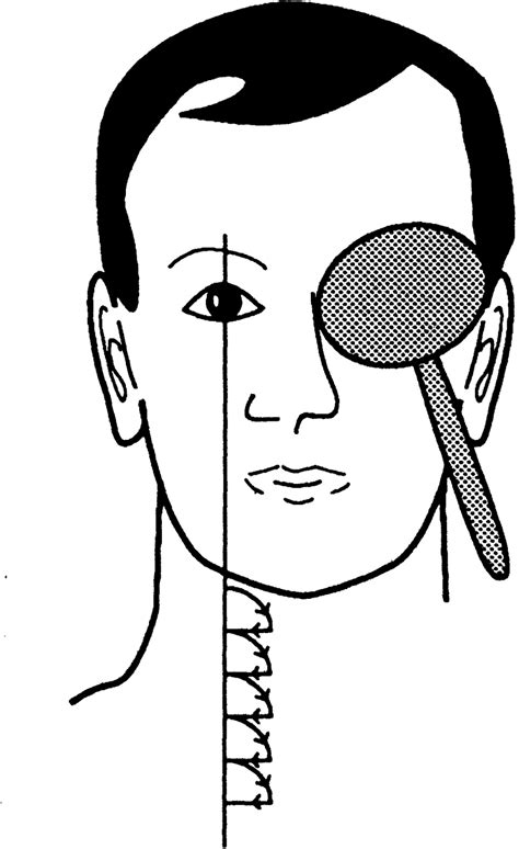 The Characteristic Waveform Of Ln The Occluded Eye Moves Synchronously Download Scientific