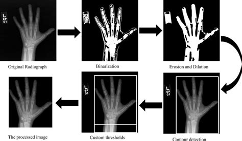 The Pipeline Of Data Preprocessing Download Scientific Diagram