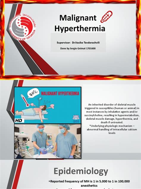 1 Malignant Hyperthermia Ppt Sergio Pdf