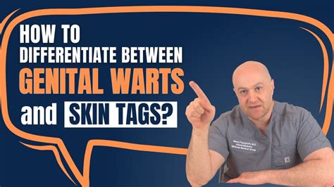 Difference Between Genital Warts And Skin Tags