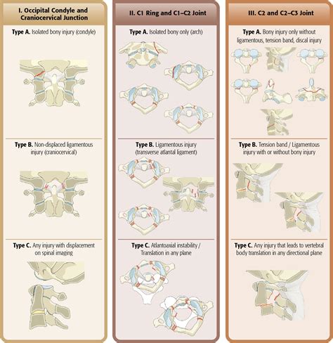 Upper Cervical Spine Trauma Clinical Tree