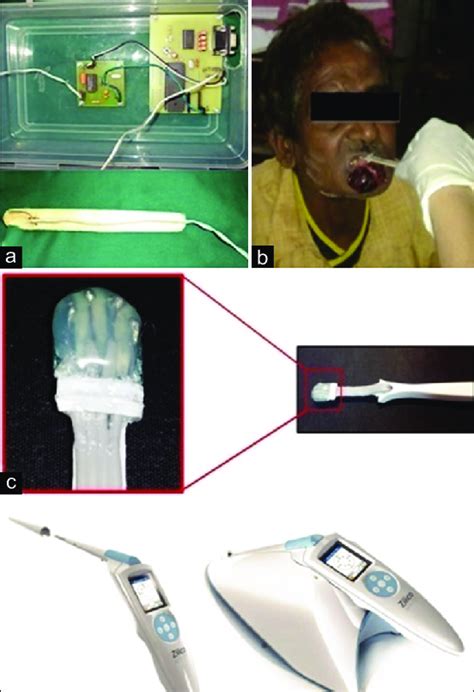 The Image Of The Bioimpedance Spectroscopy Tool Across The Included