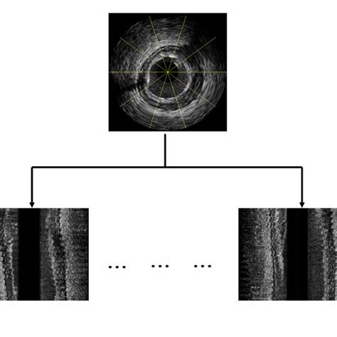 Example Of The Detection Luminal Contours On Longitudinal A Download Scientific Diagram