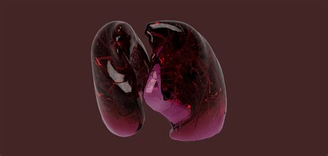 Archivo 3d Lungs With Artery Segmented Model 🫁 ・objeto Para Impresora