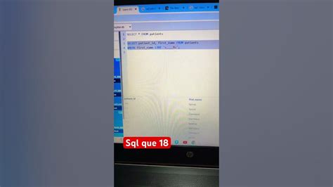 Sql Sqlserver Sqlquestions Sqlforbeginners Sqlinterviewquestions Sqltraining Data