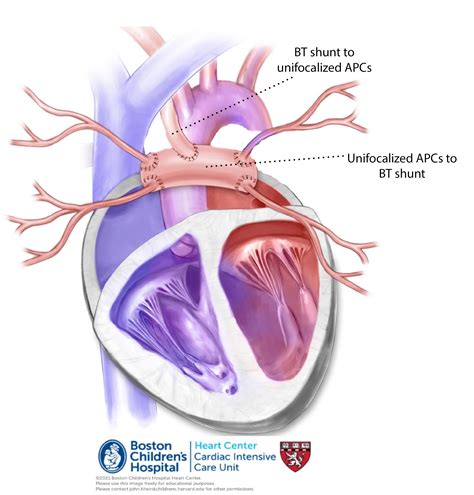 Tof Pa Online Supplement