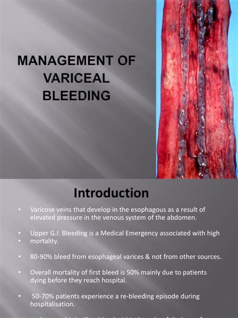 Variceal Bleeding Ffh Med 2 Pdf Cirrhosis Esophagus