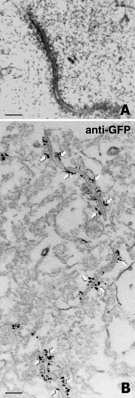 Electron Microscopy A And Immunoelectron Microscopy B Of Plc Clone