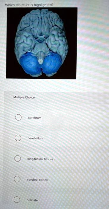 SOLVED Which Structure Is Highlighted Multiple Choice Cerebrum Cerebellum Longitudinal Fissure