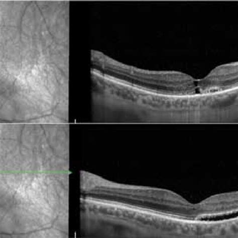 A B Horizontal And Vertical Structural Optical Coherence Tomography Download Scientific