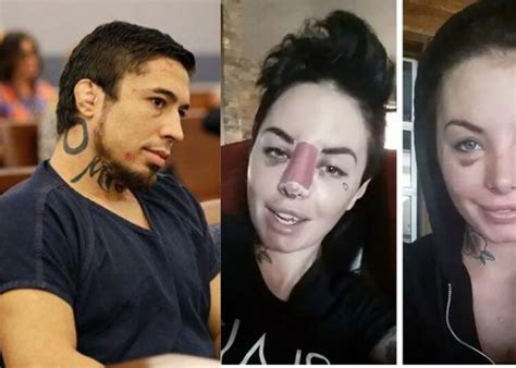 Christy Macks Plastic Surgery Nose Job See Transformation Lovely Surgery