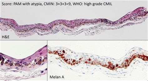 Ma Thesis Development Of A Machine Learning Algorithm For Histopathological Classification Of