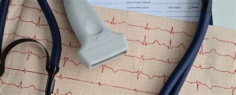 Ecocardiograma Ultrasonido Del Corazón Y Examen Del Corazón Foto De