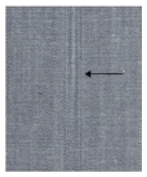 Defective Fabric Samples With Complex Patterned Textures Download Scientific Diagram