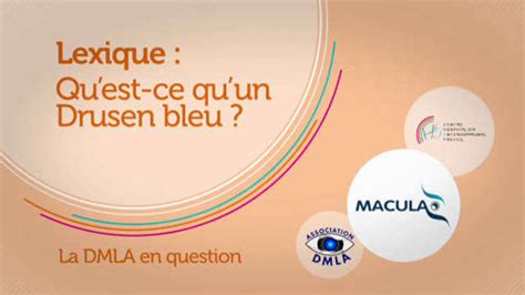 Drusen Bleu Créteil Ophtalmo