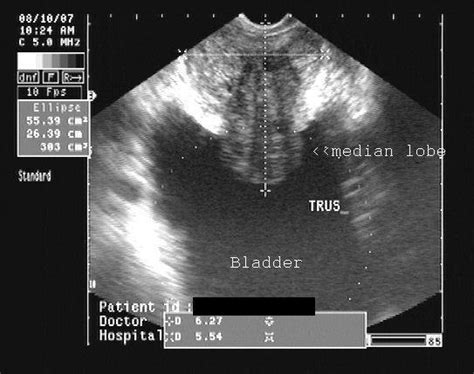 A Gallery Of High Resolution Ultrasound Color Doppler And 3d Images