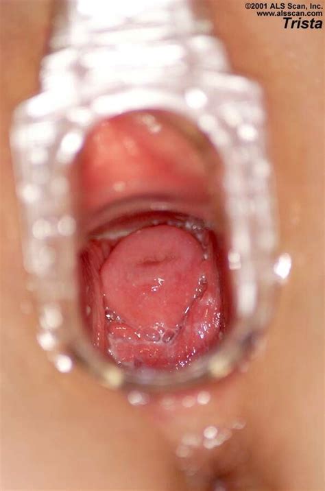 Girls From ALS Scan Photo X Vid Com