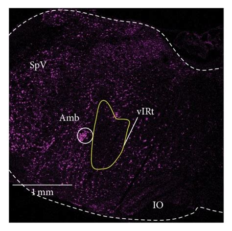 Facial Motoneurons And Whisking A Δg Rabies Injection Into The Download Scientific Diagram