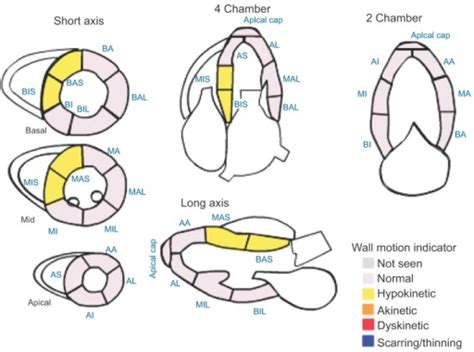 Echocardiogram Anatomy