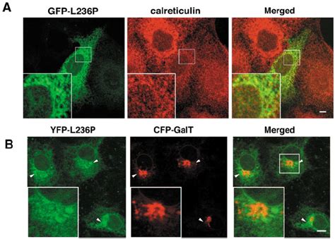 Determination Of Intracellular Localization Of Gfp L236p By