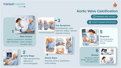 Aortic Valve Calcification Symptoms Causes Treatment And Risks