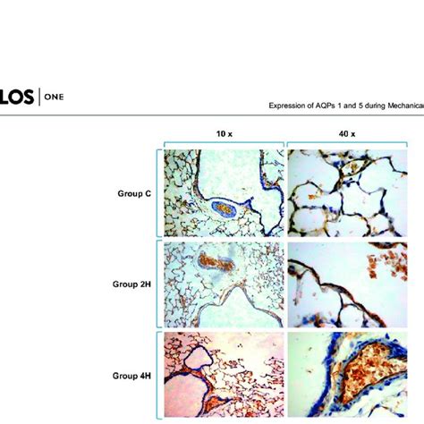 Immunohistochemistry Of Aqp 1 The Dye Demarks The Microvascular