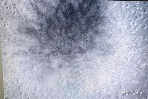 细胞培养中的真菌污染 知乎