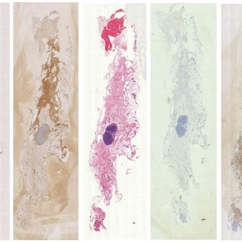 Histology Cima Dataset Kaggle