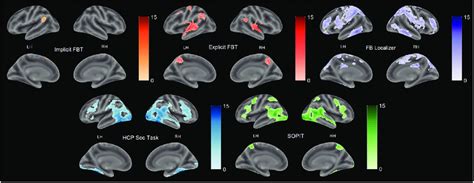 Results Of Whole Brain Analysis The Figure Presents Active Areas For