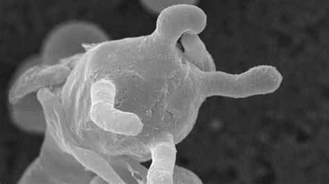 Fungal Disease Spreads Through Pacific Northwest Npr