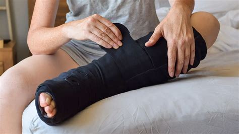 A Patients Guide To Lymphovenous Bypass Surgery