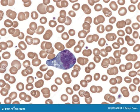 Diffuse Large B Cell Lymphoma Dlbcl Closeup View 3d Illustration Royalty Free Stock Image