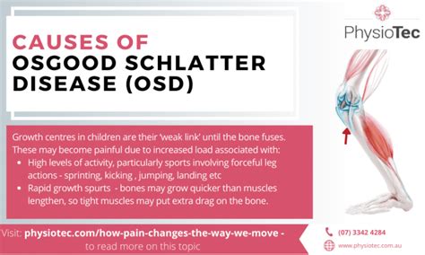 Osgood Schlatter Disease Symptoms Causes Treatment