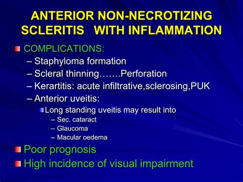 Episcleritis And Scleritis Ppt
