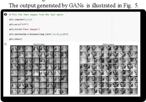 Figure 5 From Lung Disease Detection From Chest X Ray Using Gans