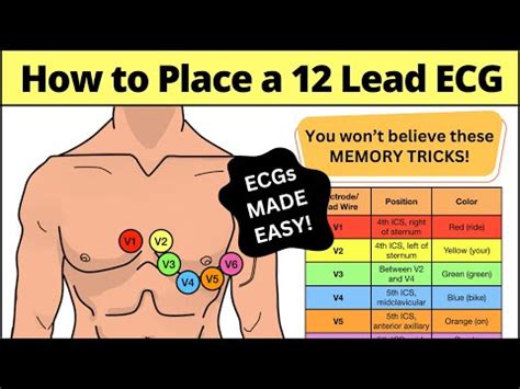 How Should Electrocardiogram Ecg Chest Leads Be Placed