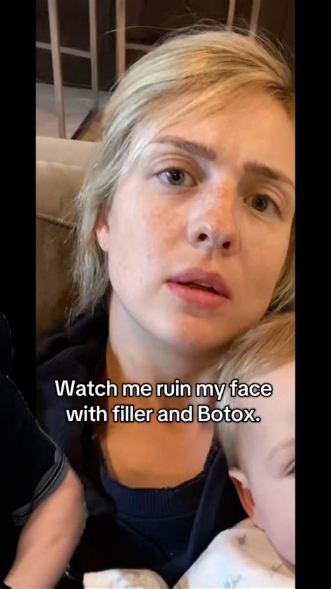 Dylan Greeney Md Dermatologists Advice On Botox And Filler Og Video Credit The Austin