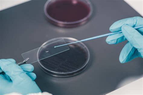 Impulsar La Innovación Para Desarrollar Antibióticos Eficaces Frente Al