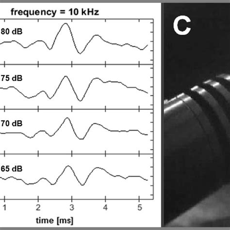 Cochlear Hair Cell Preparation Sample Microphotograph With Scale Bar