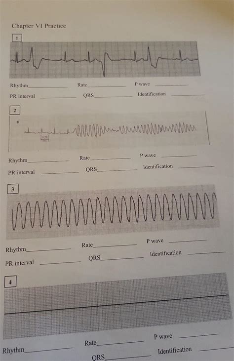 Chapter VI Practice Rhythm Rate P Wave PR Interval Chegg Com