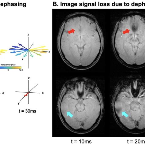 Signal Loss From Spin Dephasing Download Scientific Diagram
