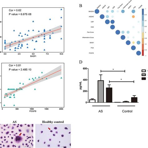 Cytokines Detected In As Patients And Healthy Controls A Top Pathway