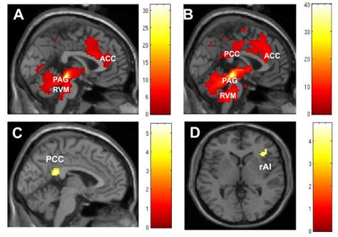Functional Connectivity Results A Positive Functional Connectivity Download Scientific