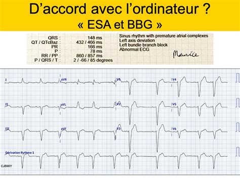 Physiologie Page 8 Sur 18 E Cardiogram Physiologie Page 8 Sur 18 E Cardiogram