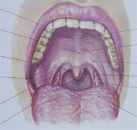Swollen Soft Palate And Uvula Uvula Inflammation Treatment Eicqn