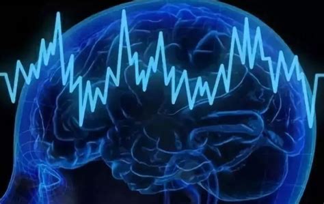 诊断癫痫病需要做什么检查？ 知乎