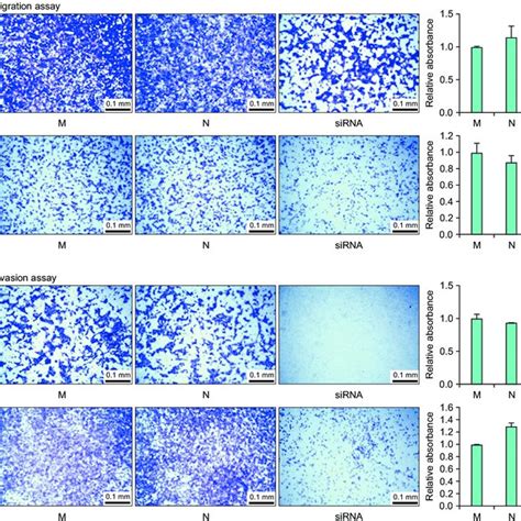 Effect Of The Small Interfering Rna Sirna Mediated Knockdown Of