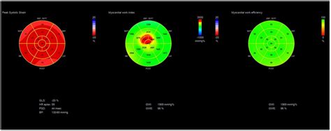 Myocardial Work Methodology And Clinical Applications